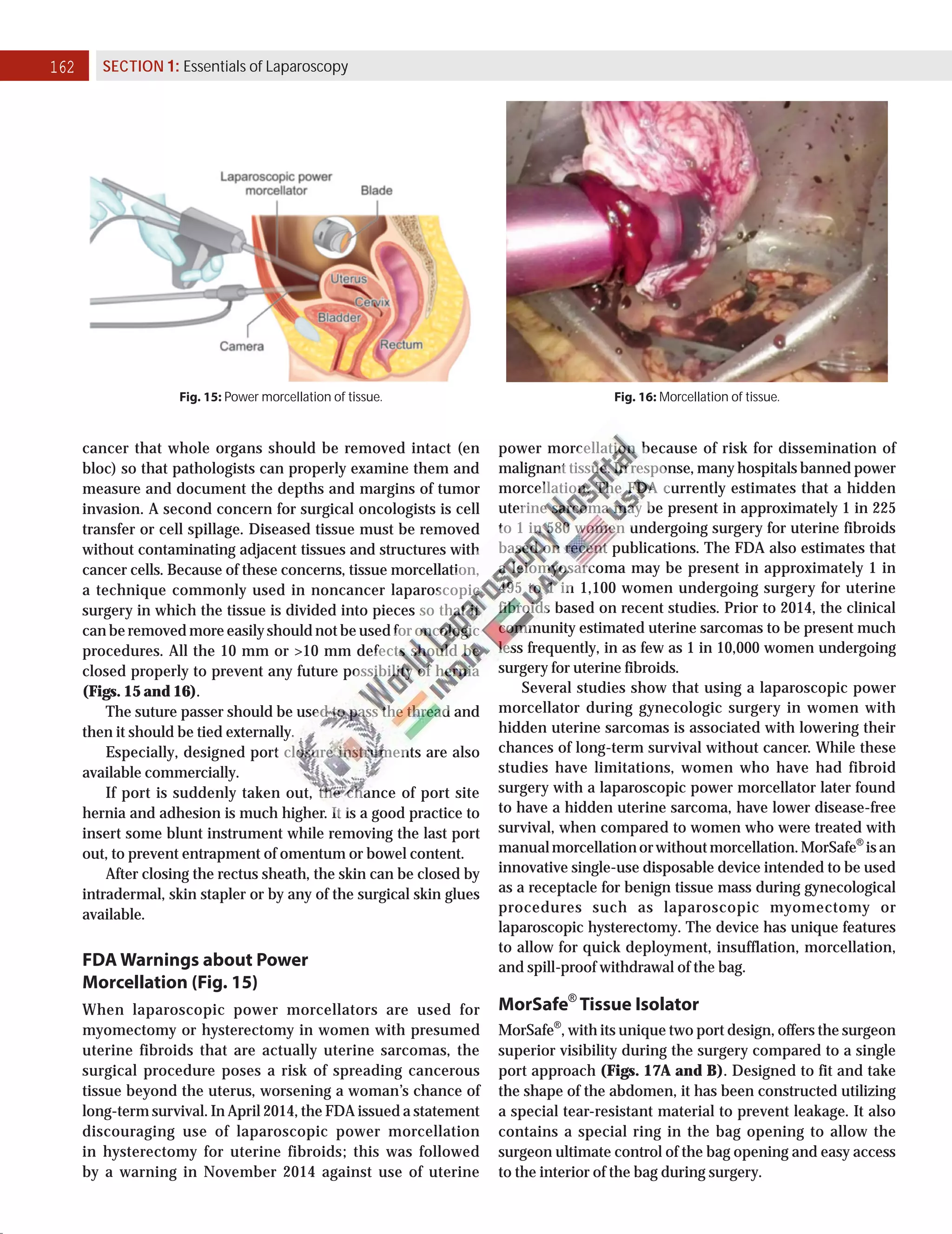 Tissue Retrieval Technique | PDF