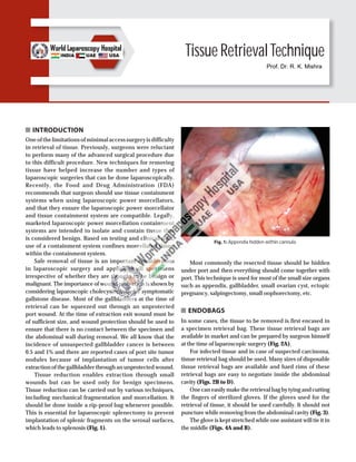 Tissue Retrieval Technique | PDF
