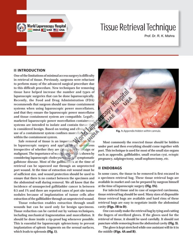 Tissue Retrieval Technique | PDF