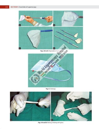 Tissue Retrieval Technique | PDF