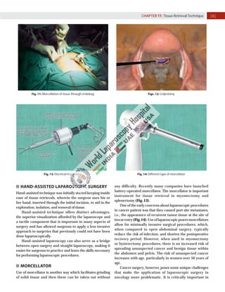 Tissue Retrieval Technique | PDF