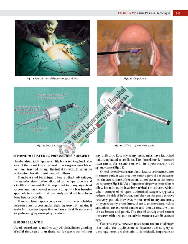 Tissue Retrieval Technique | PDF