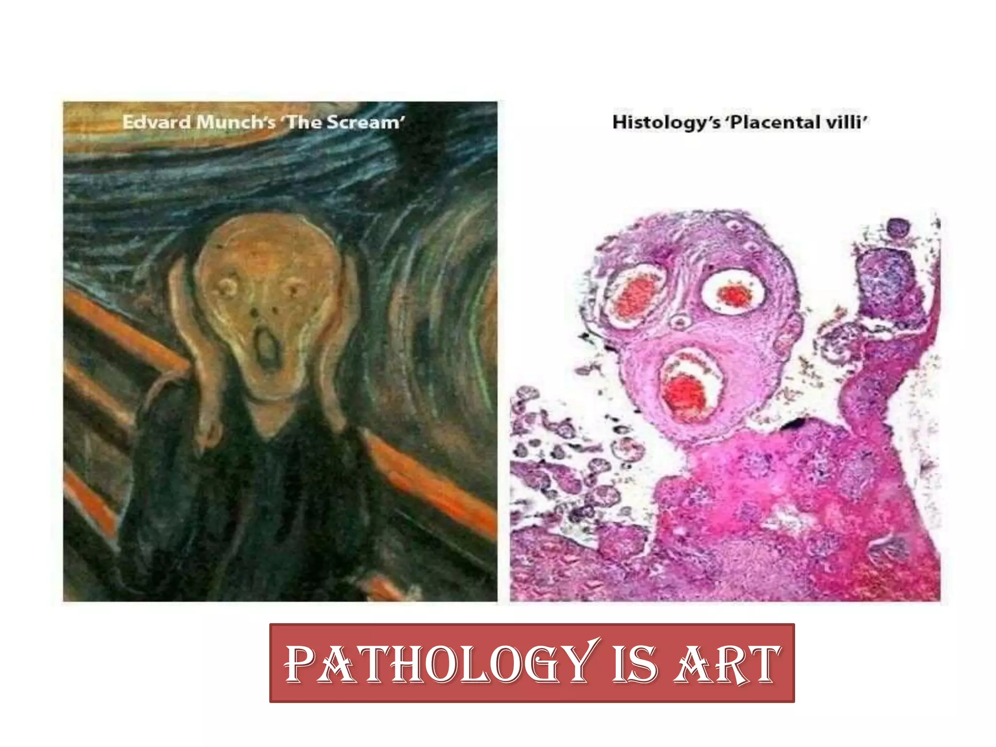 Tissue accumulation | PDF