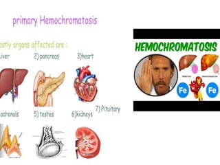 Tissue accumulation | PPT
