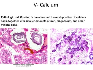 Tissue accumulation | PPT