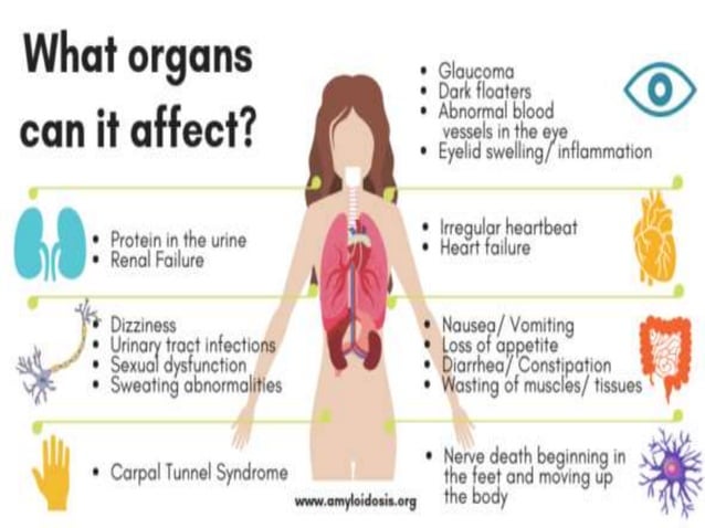 Tissue accumulation | PPT
