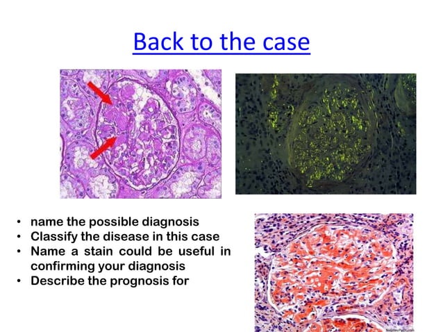 Tissue accumulation | PDF
