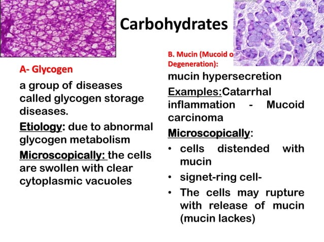 Tissue accumulation | PPT