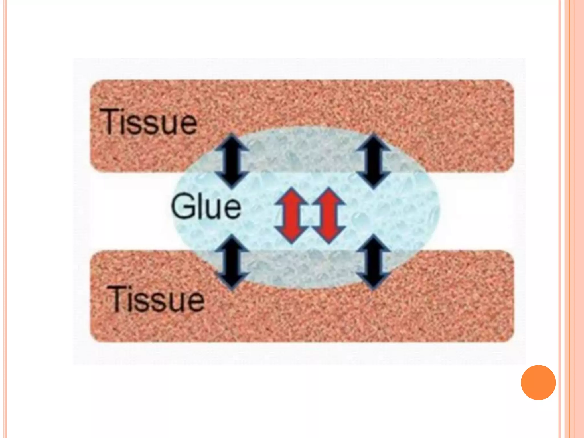 Tissue adhesives | PPTX