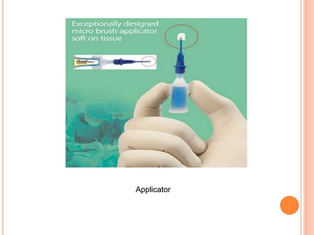 Tissue adhesives | PPTX