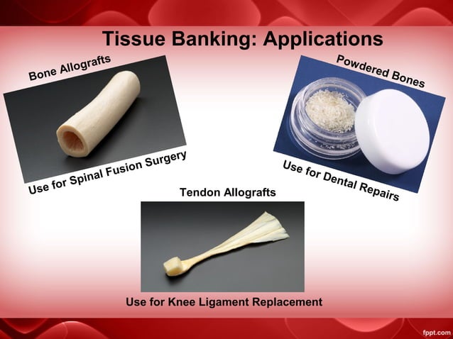 Tissue bank & it's status in bangladesh | PPT