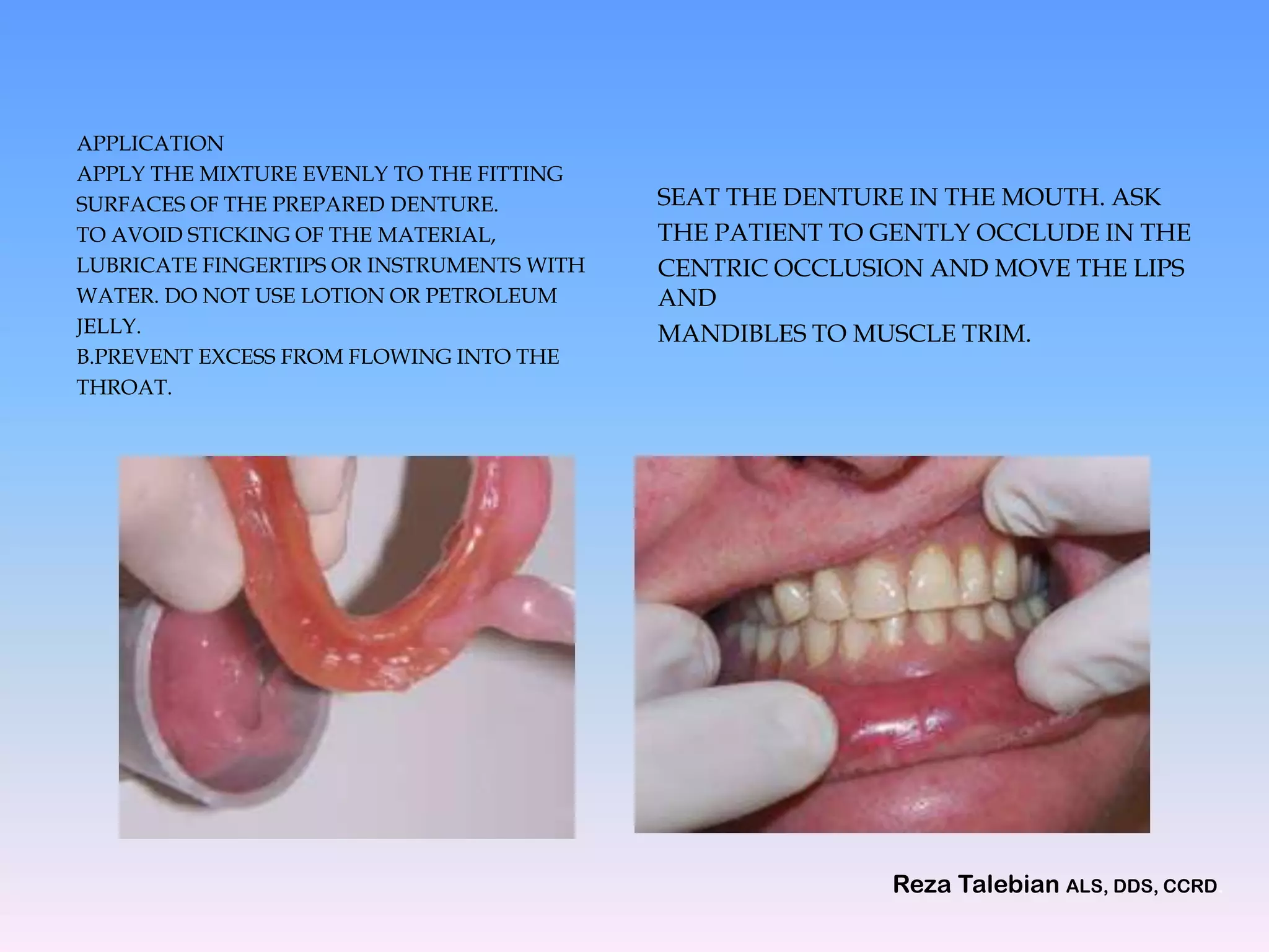 Tissue conditioner / Soft liner | PPTX