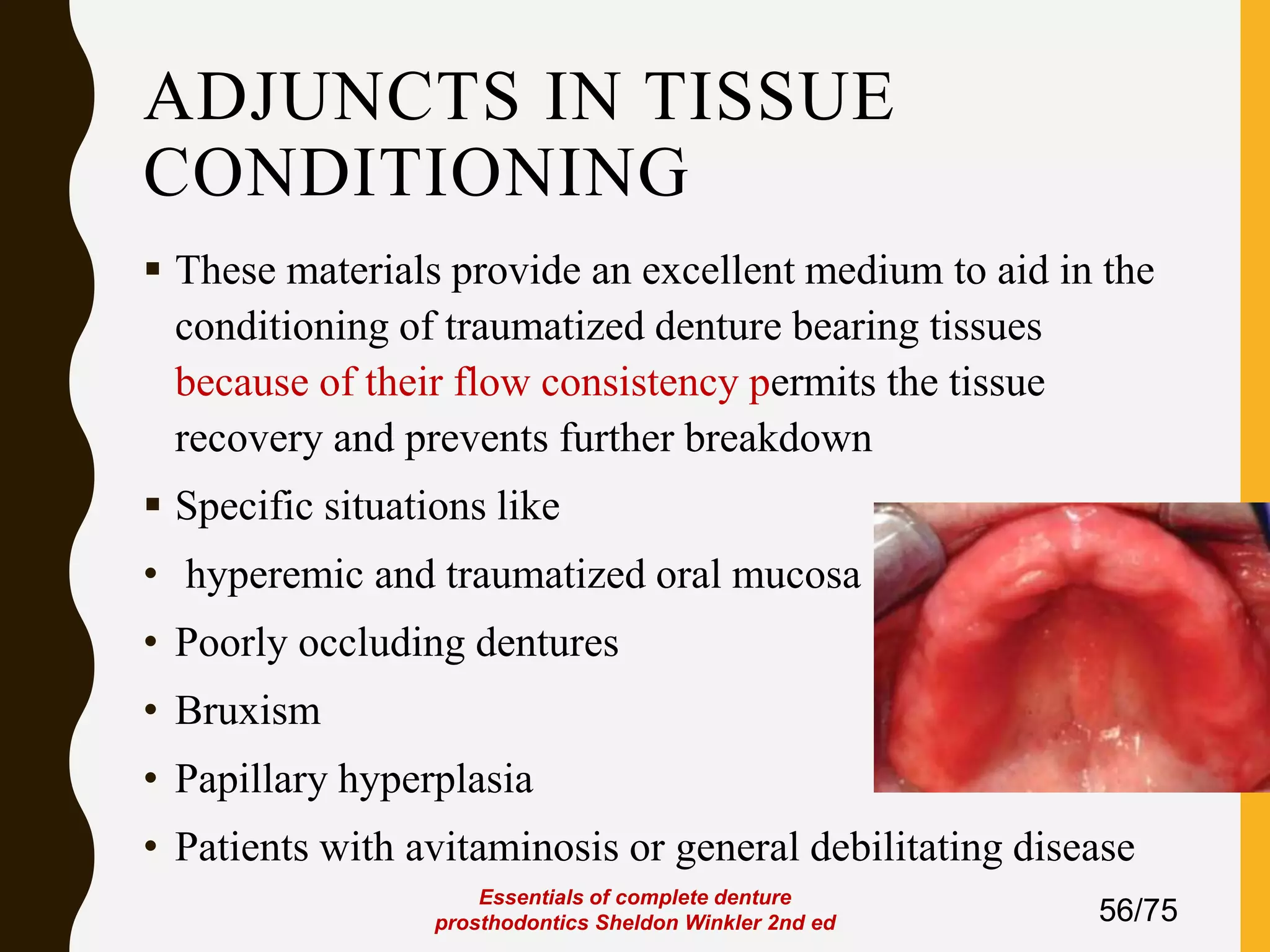Tissue conditioners | PPTX