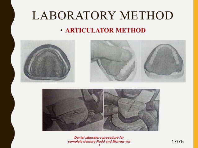 Tissue conditioners | PPTX | Oral care | Personal Care