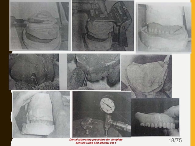 Tissue conditioners | PPTX | Oral care | Personal Care