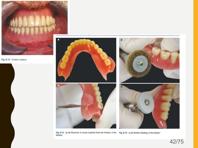 Tissue conditioners | PPTX | Oral care | Personal Care