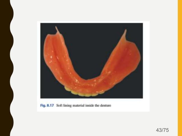 Tissue conditioners | PPTX | Oral care | Personal Care