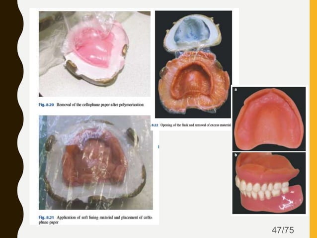 Tissue conditioners | PPTX | Oral care | Personal Care