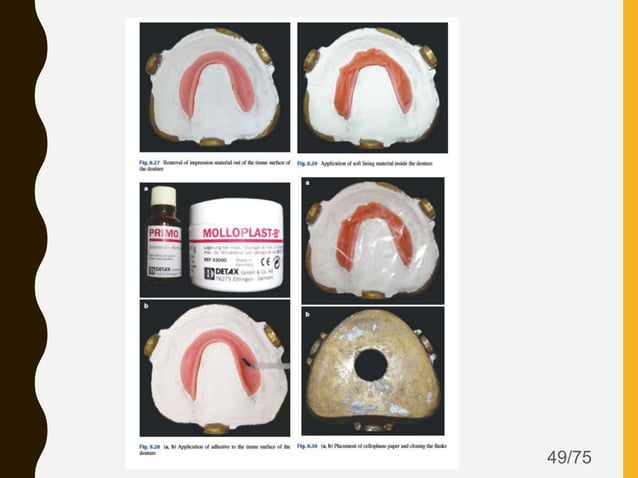 Tissue conditioners | PPTX | Oral care | Personal Care
