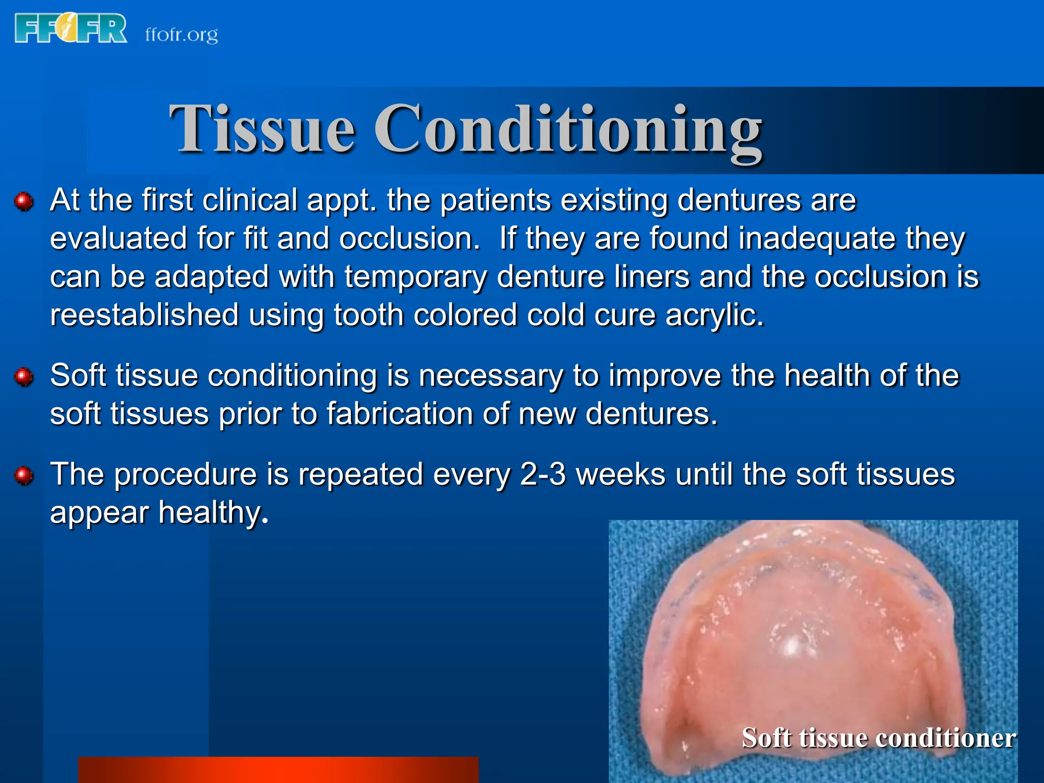 tissue conditioners 4th yr.ppthbhjjhsgjygdu | PPT