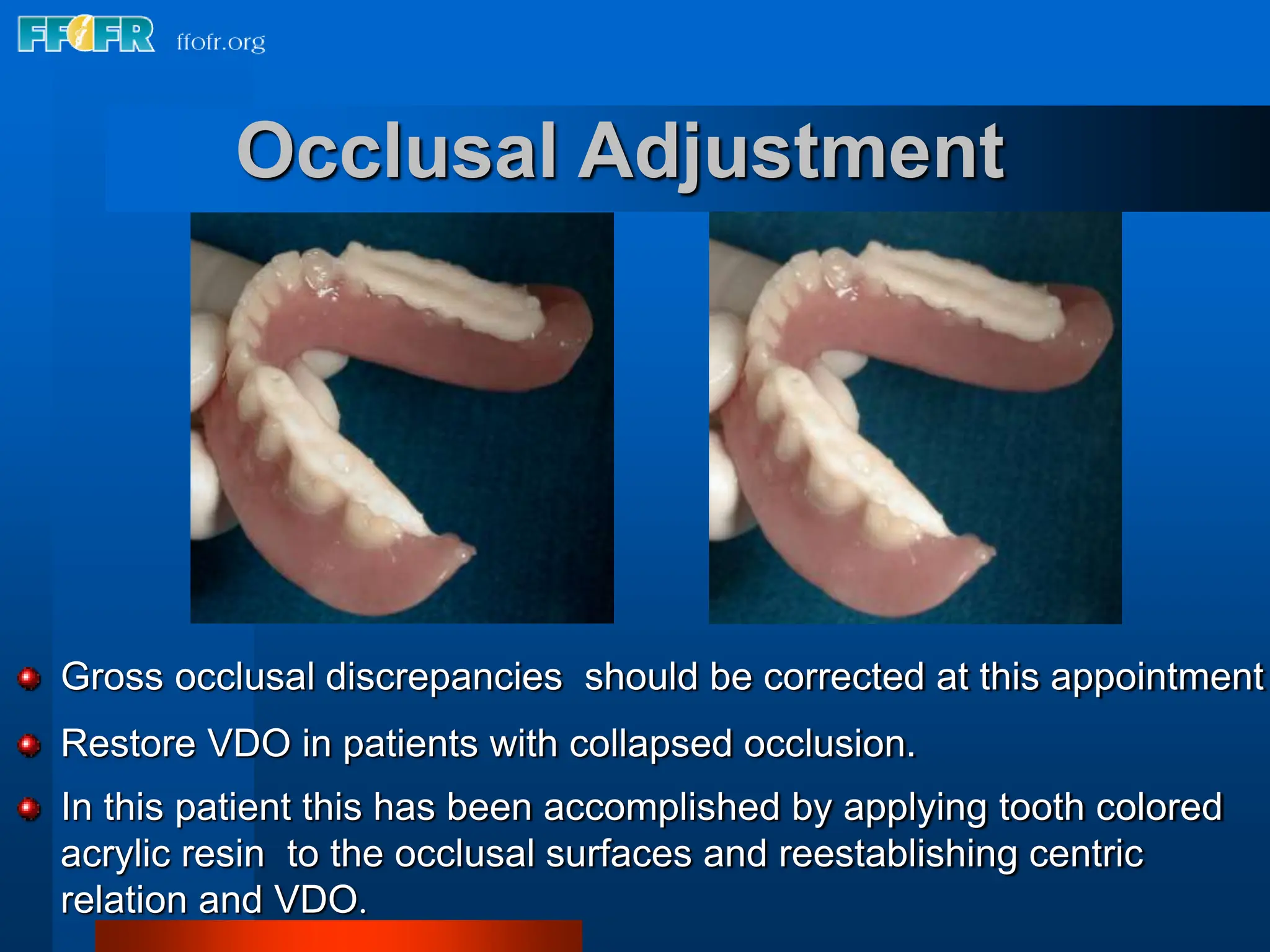 tissue conditioners 4th yr.ppthbhjjhsgjygdu | PPT