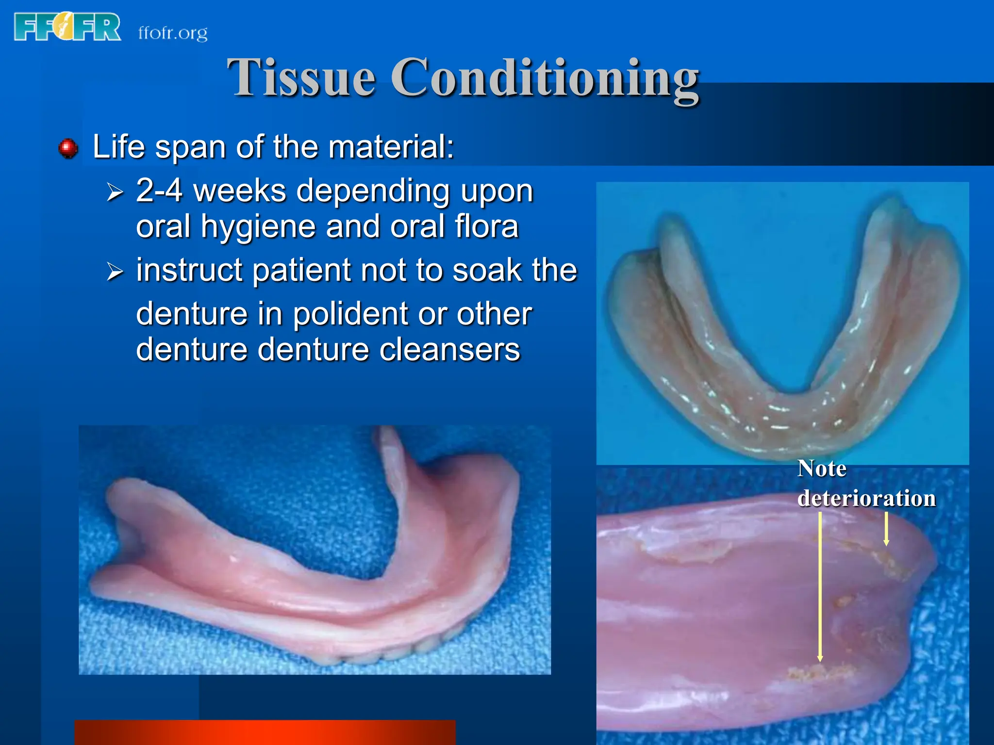 tissue conditioners 4th yr.ppthbhjjhsgjygdu | PPT