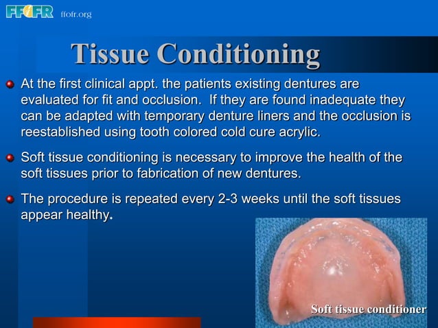 tissue conditioners 4th yr.ppthbhjjhsgjygdu | PPT