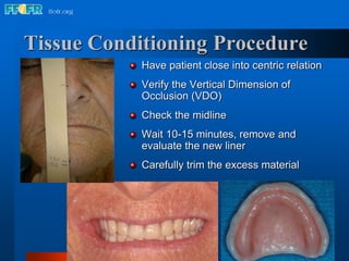 tissue conditioners 4th yr.ppthbhjjhsgjygdu | PPT
