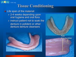 tissue conditioners 4th yr.ppthbhjjhsgjygdu | PPT