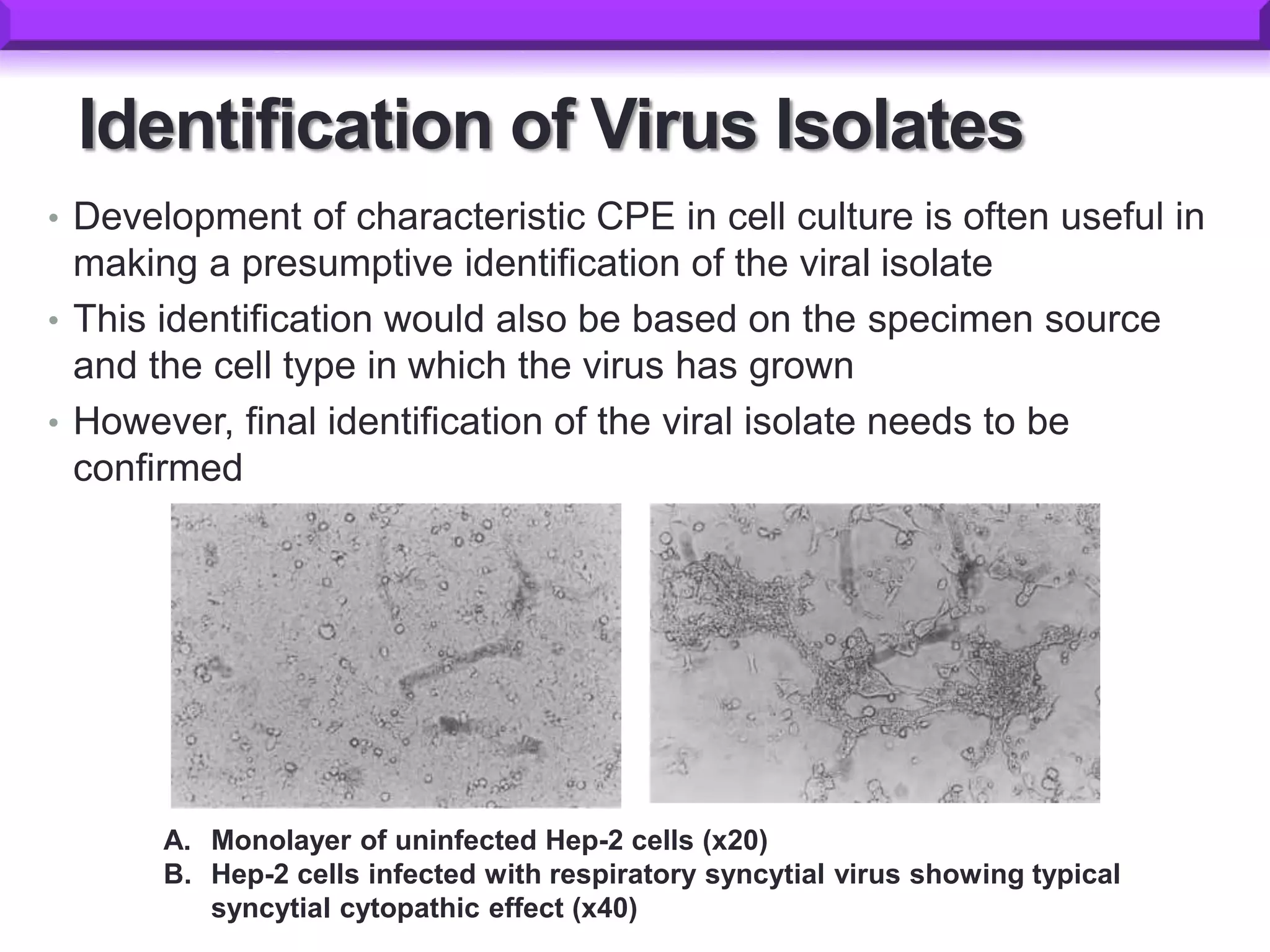 Tissue culture and virology (cpe, plaque assay) | PPTX