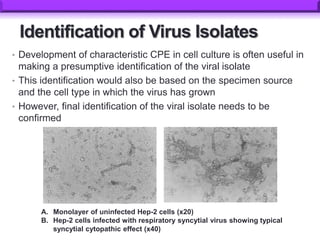 Tissue culture and virology (cpe, plaque assay) | PPTX