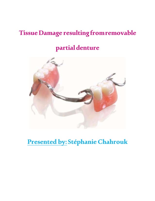 Tissue damage resulting from removable partial denture | DOCX