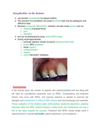 Tissue damage resulting from removable partial denture | DOCX