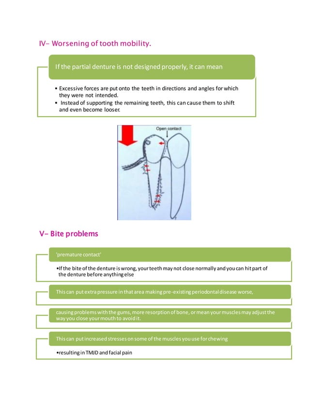 Tissue damage resulting from removable partial denture | DOCX