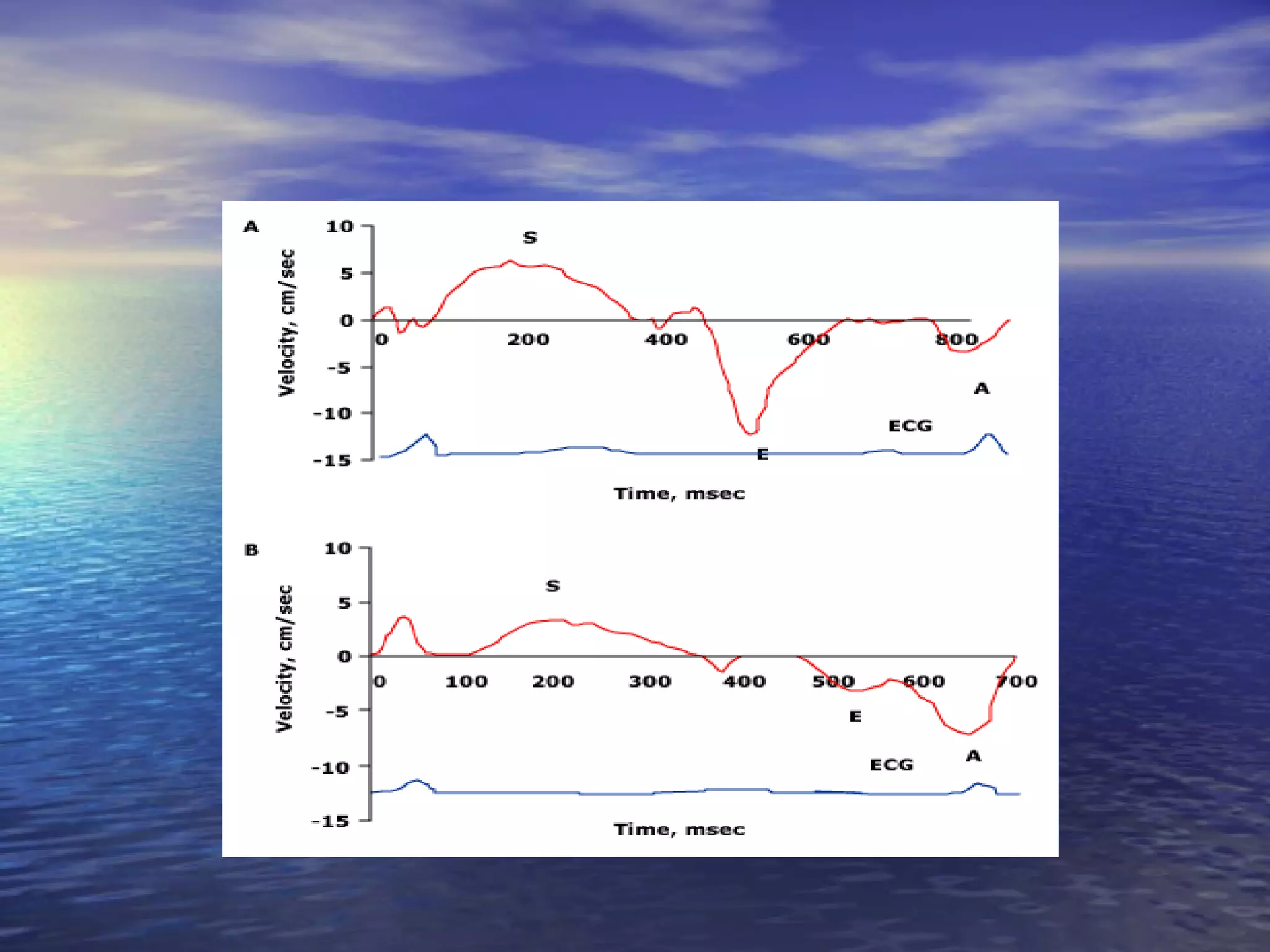 Tissue doppler imaging | PPT