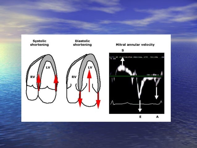 Tissue doppler imaging | PPT