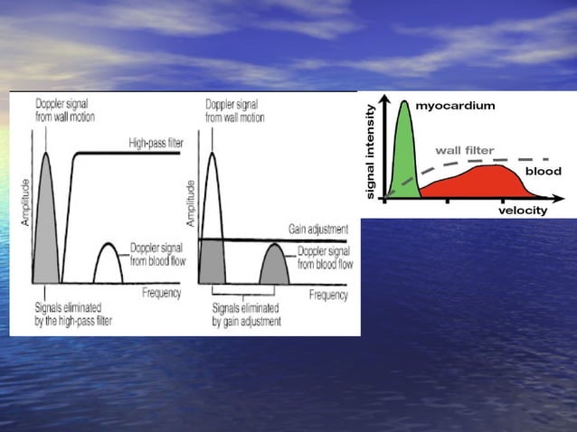 Tissue doppler imaging | PPT
