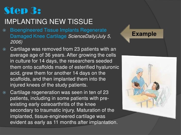 Content – Tissue Engineering