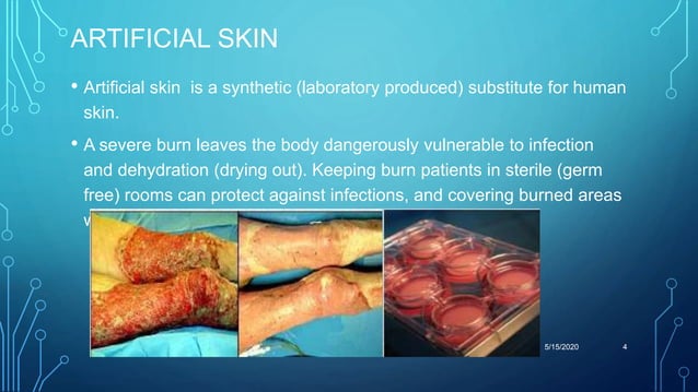 Tissue engineering artificial skin | PPTX | Skin and Dermatology ...