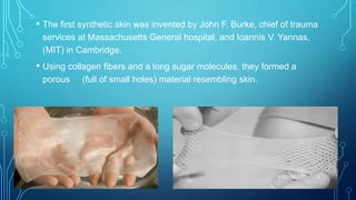 Tissue engineering artificial skin | PPTX