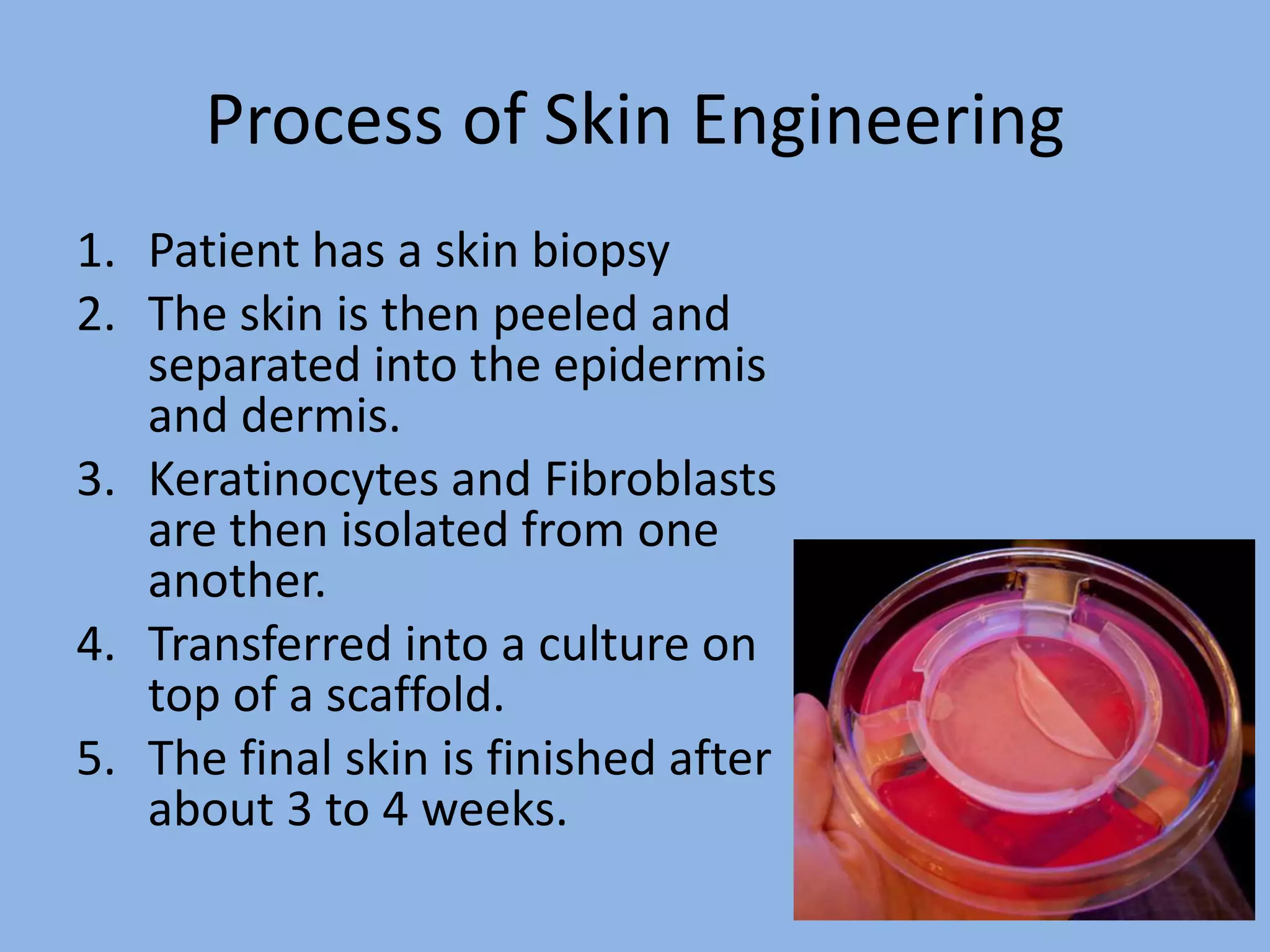 Tissue Engineering of the Skin.ppt