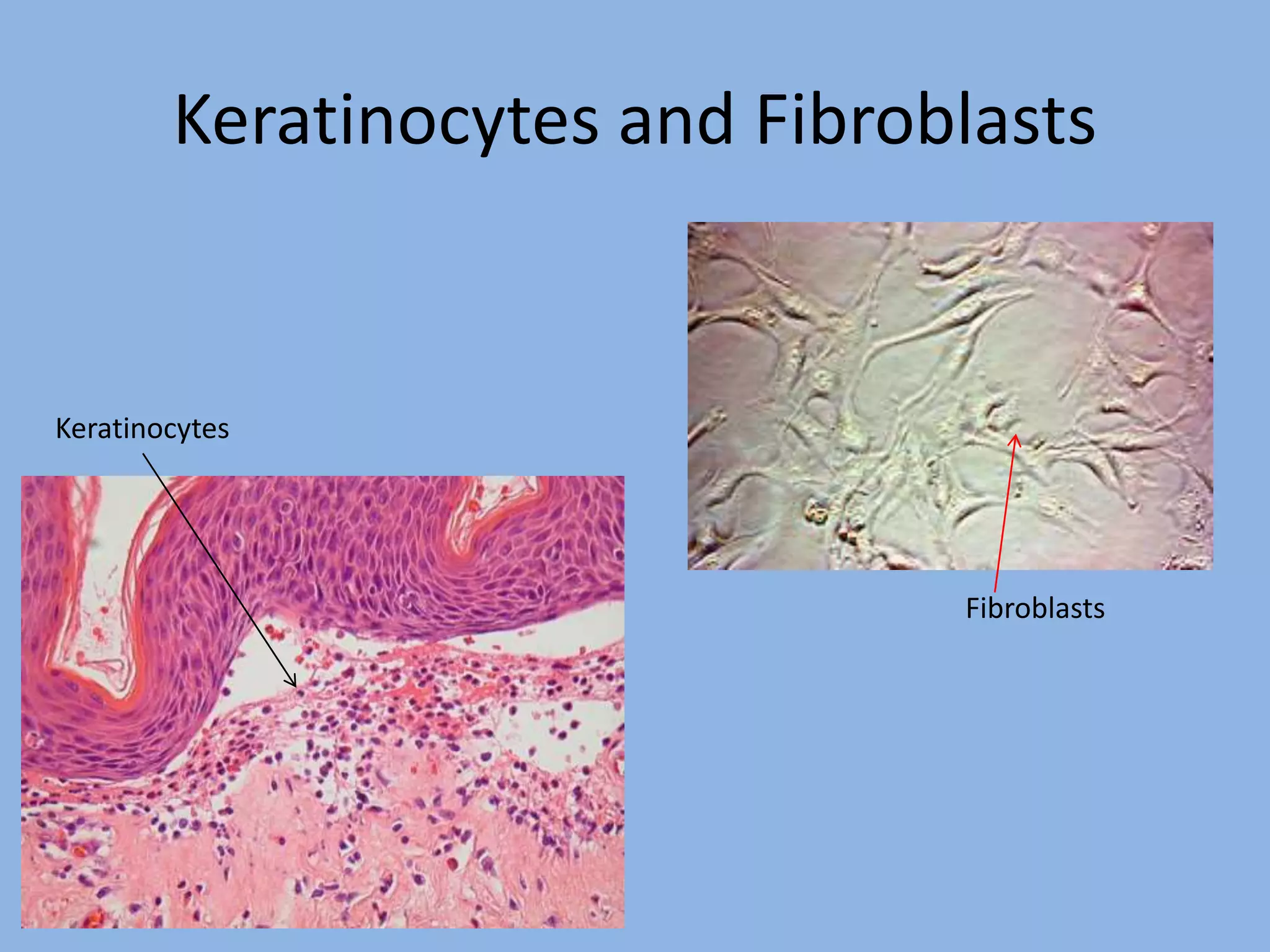 Tissue Engineering of the Skin.ppt