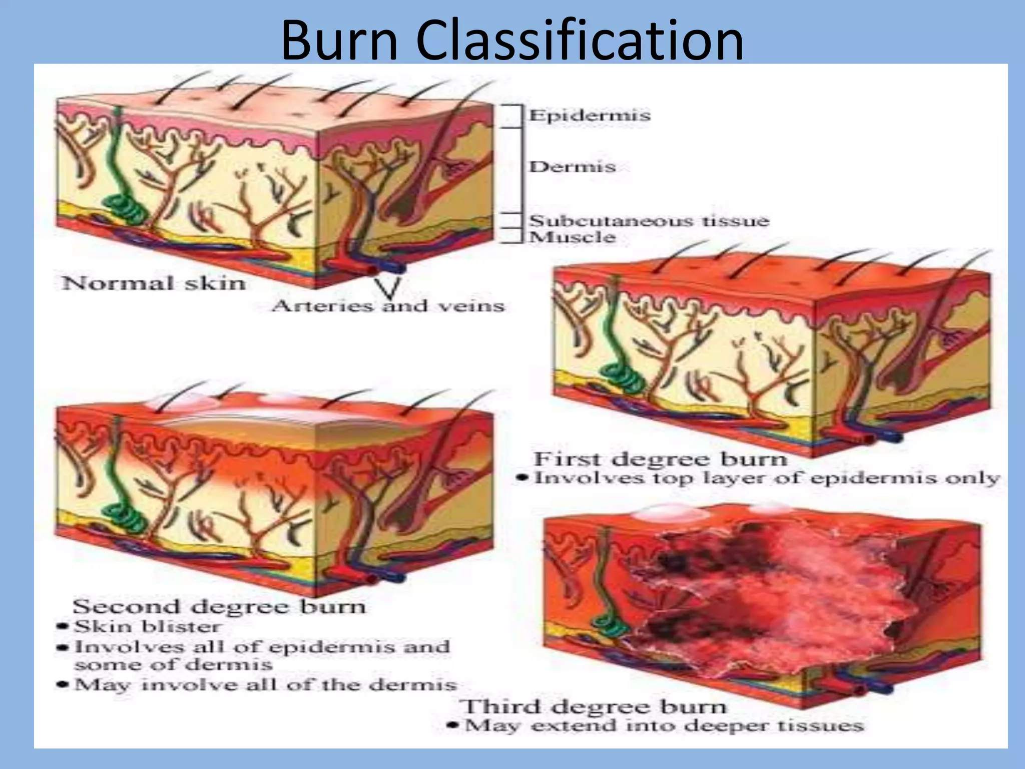 Tissue Engineering of the Skin.ppt