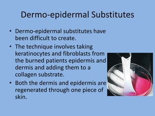 Tissue Engineering of the Skin.ppt