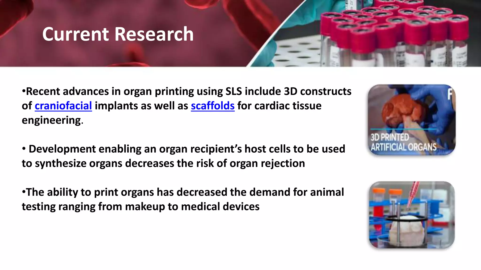 Tissue engineering - solvent casting particulate leaching and selective ...