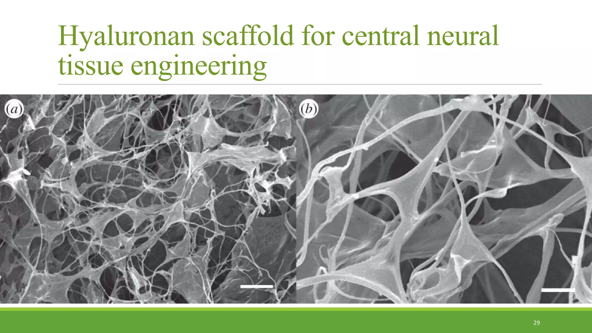 Tissue Engineering: Scaffold Materials | PPTX