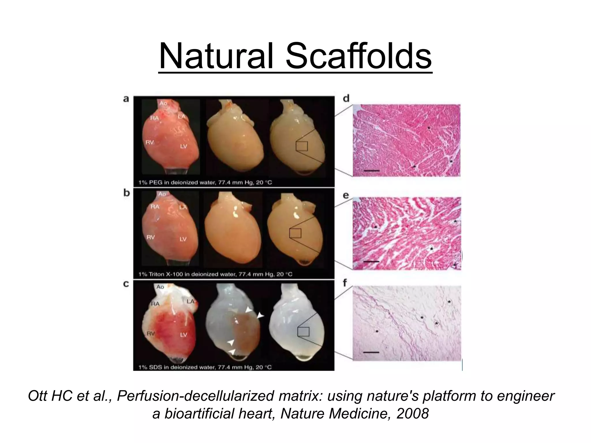 Tissue Engineering & Regenerative Medicine | PPTX