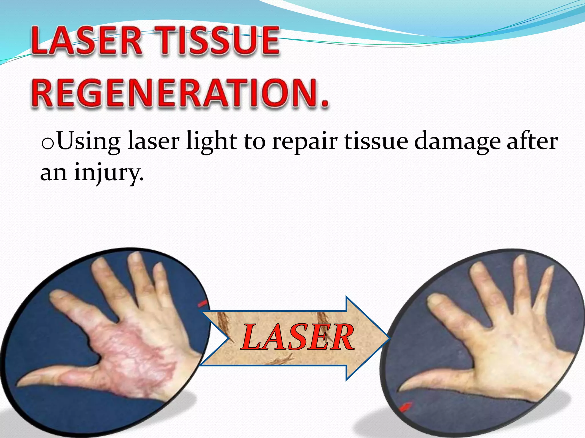 Tissue engineering with light | PPTX
