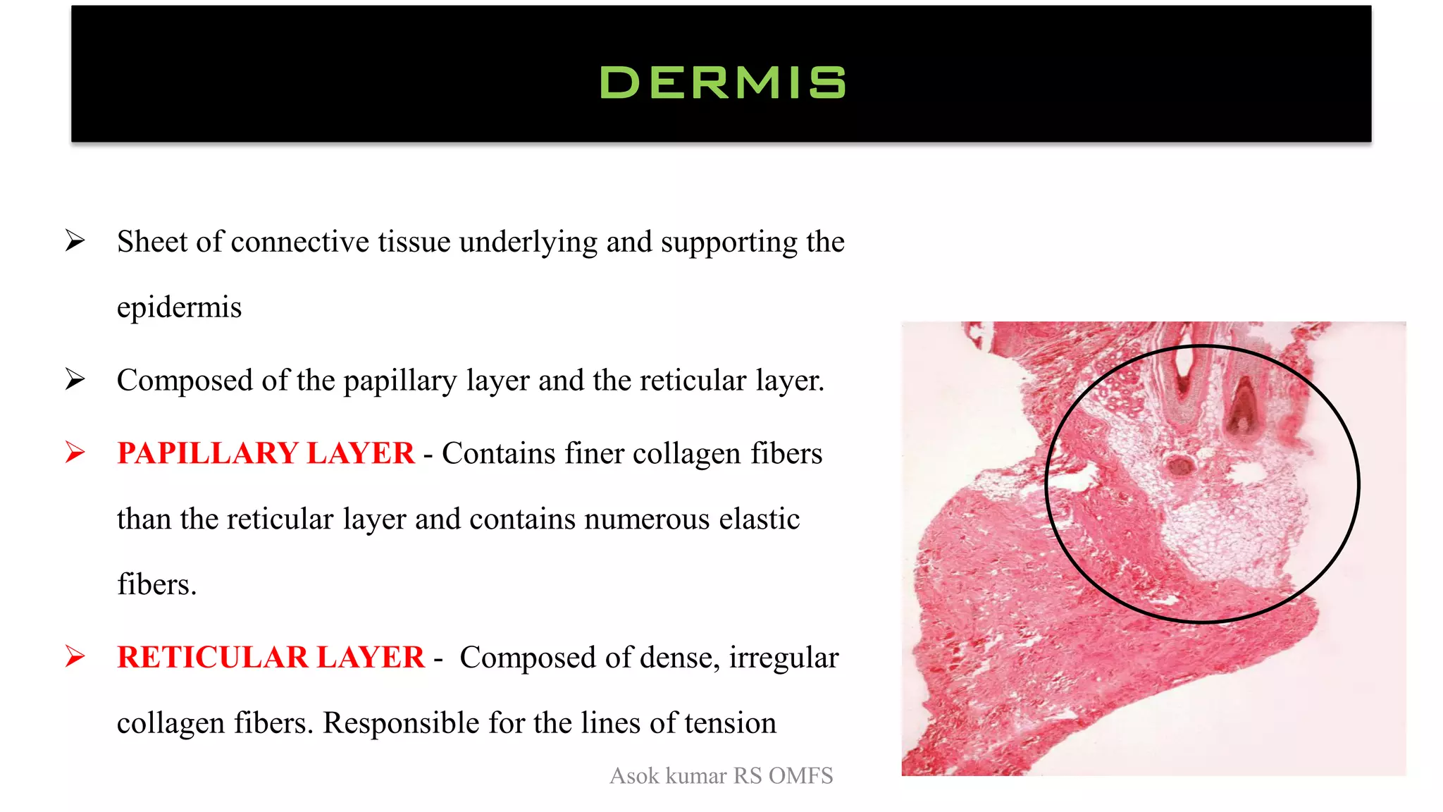 Tissue expander in omfs | PDF