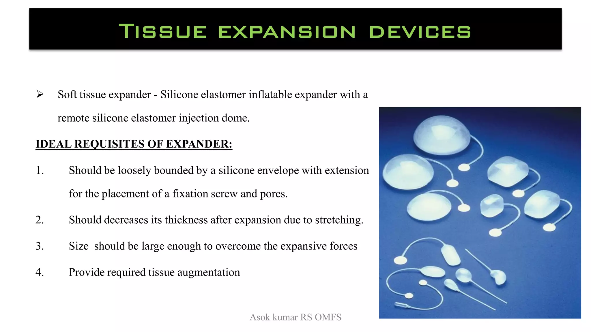 Tissue expander in omfs | PDF